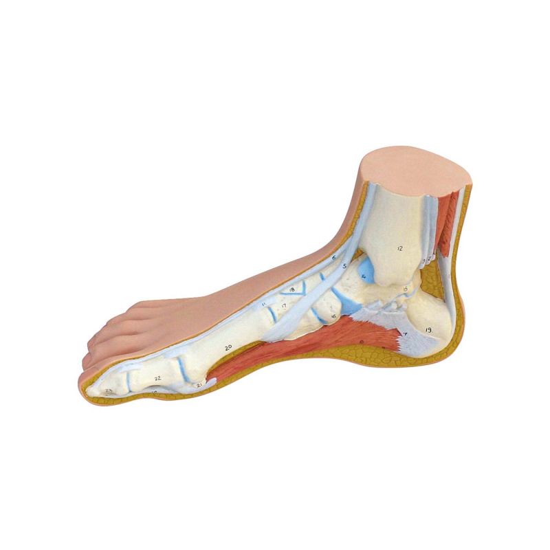 Normal Hollow And Flat Foot Structure Model LabWorld co uk Normal Hollow And Flat Foot Structure Model LabWorld co uk