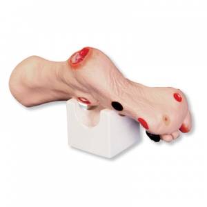 Optional Pressure Ulcer Foot - LabWorld.co.uk