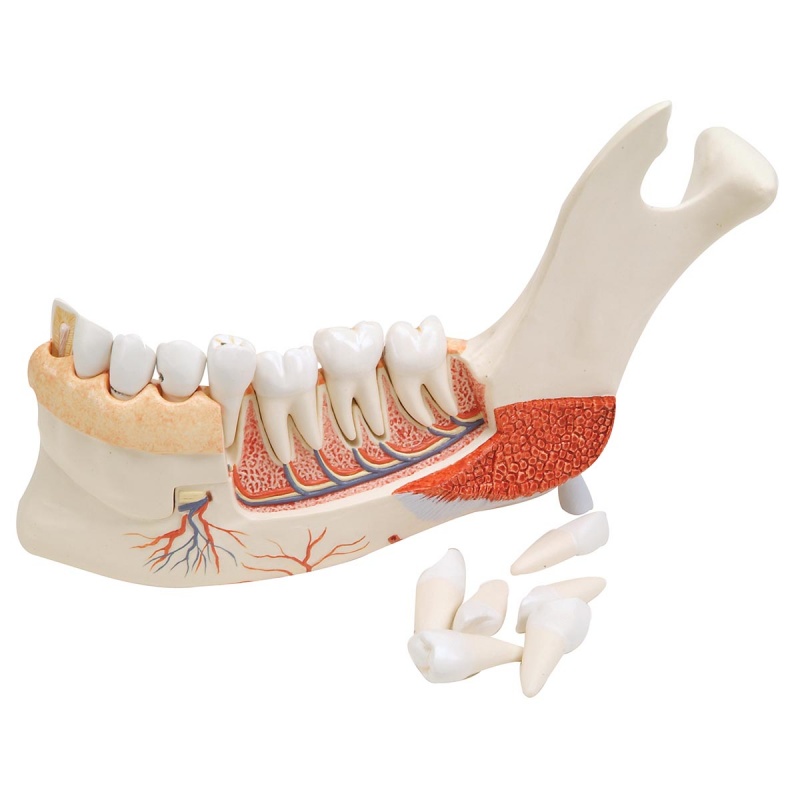 Advanced Half Lower Jaw Model with 8 Diseased Teeth (19-Part ...