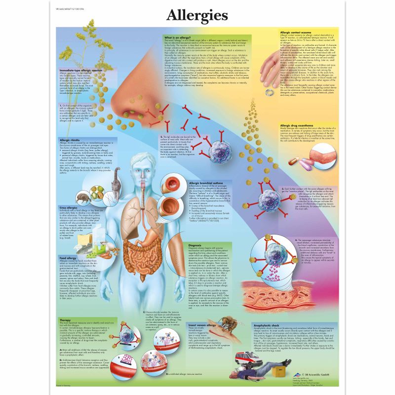 Allergies Chart - LabWorld.co.uk