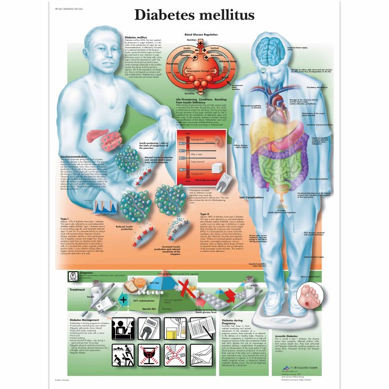 Diabetes Mellitus Chart - LabWorld.co.uk