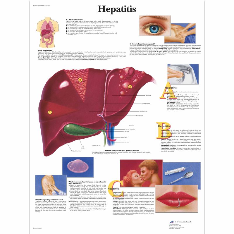Hepatitis Chart - LabWorld.co.uk