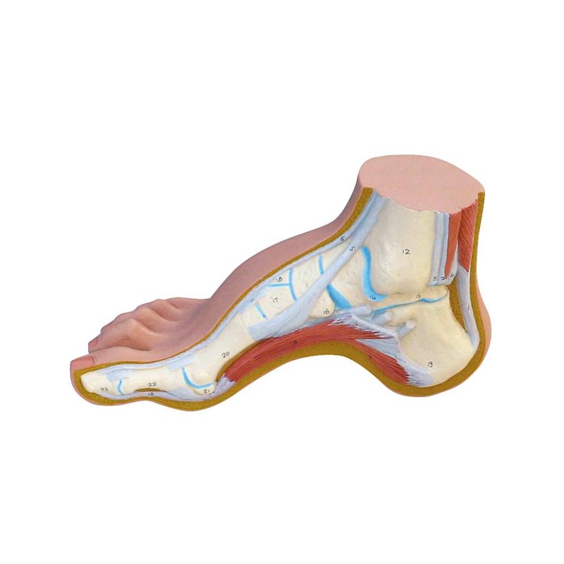 Normal, Hollow and Flat Foot Structure Model - LabWorld.co.uk